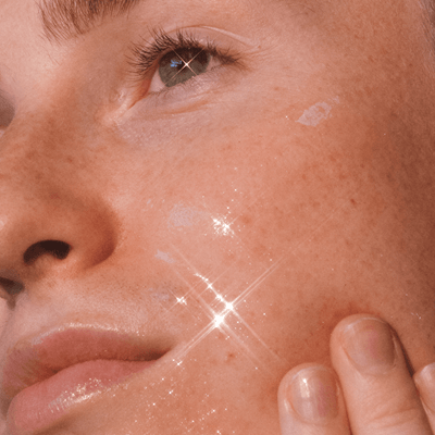 How to Differentiate Melasma from Freckles?